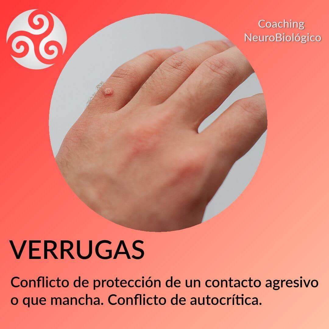 Biodescodificación de las Verrugas - Coaching de Salud Integral.